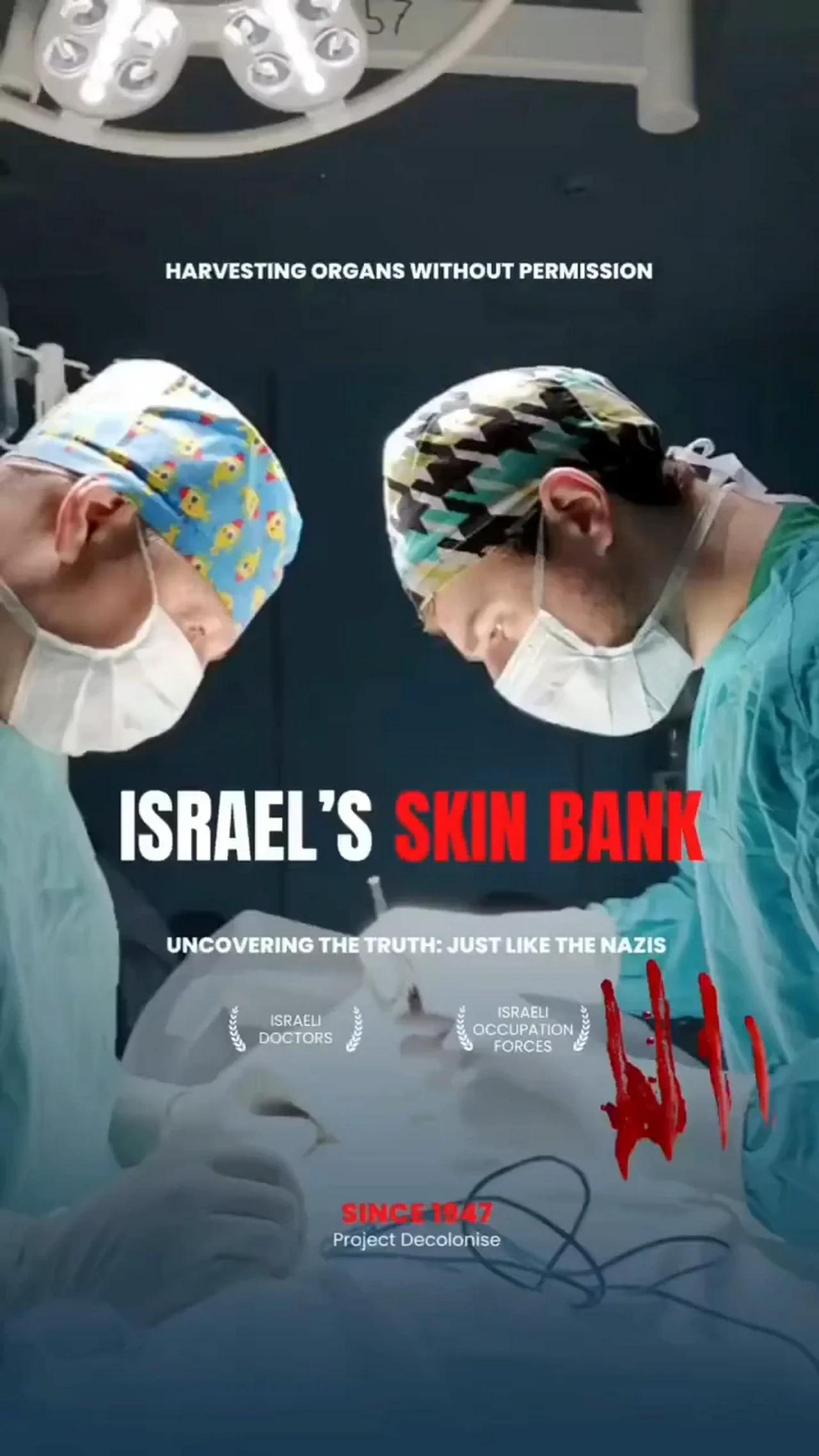 israel's human skin bank