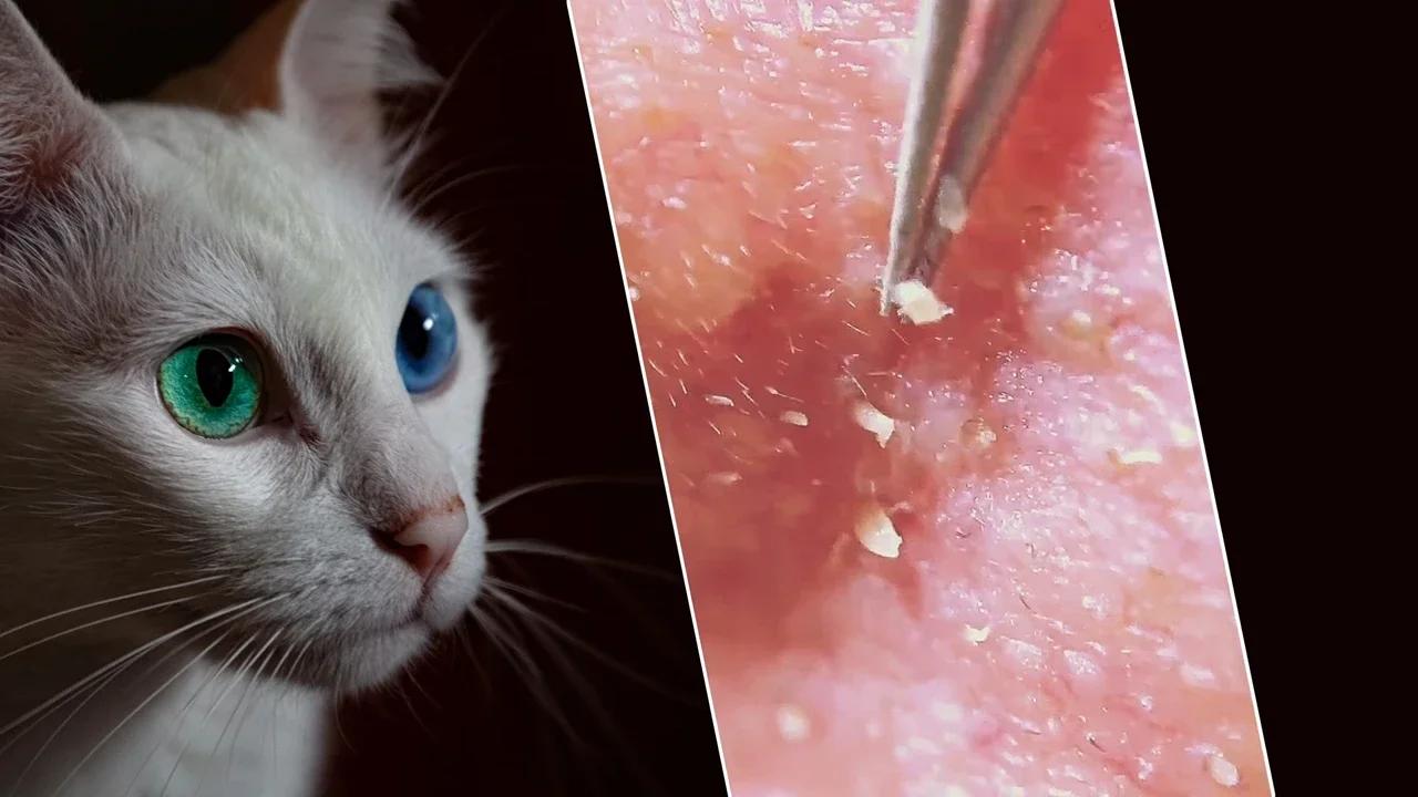 Removing Sebaceous Filaments On the Nose - Blackheads and Whiteheads ...