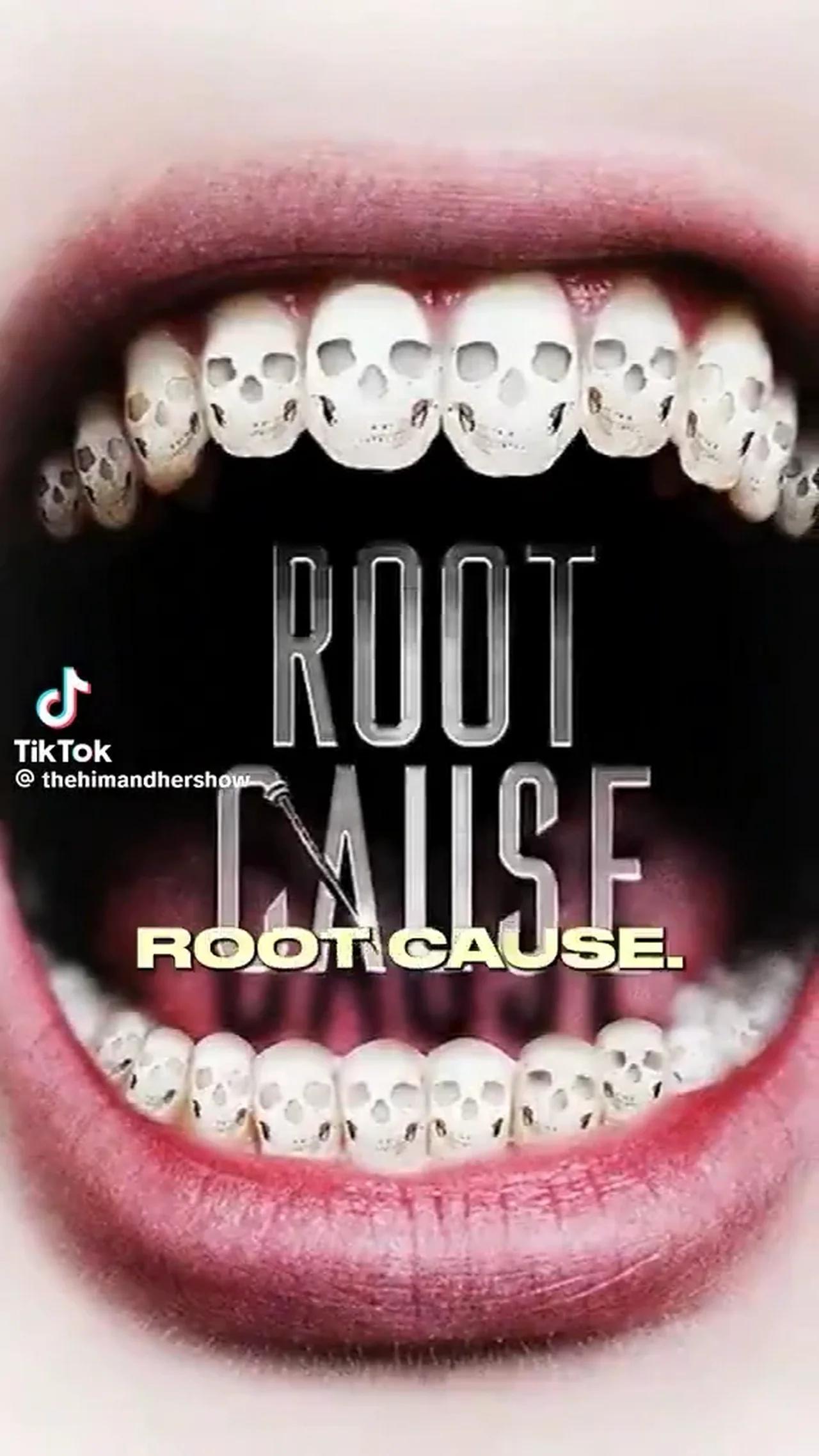Netflix Pulls Documentary On Root Canals Causing Cancers After Dentists ...