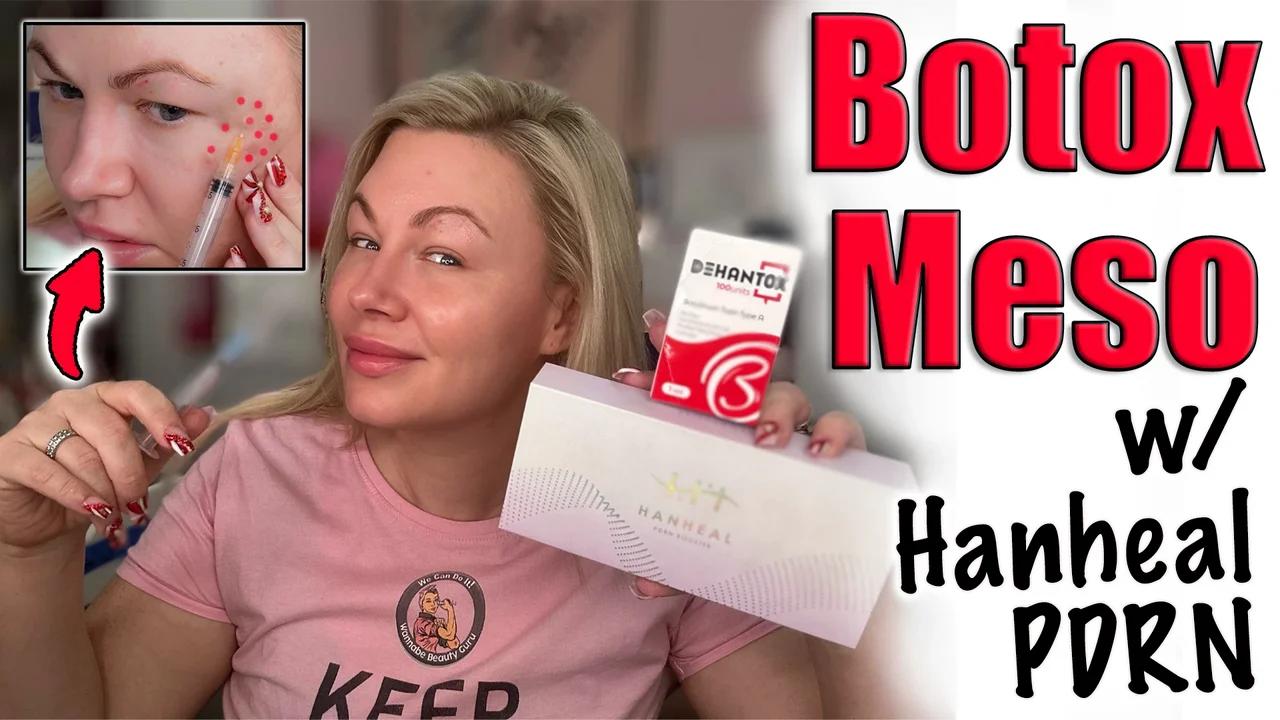 Botox Meso w/ Hanheal Pdrn and Dehantox! AceCosm.com and code Jessica10 ...
