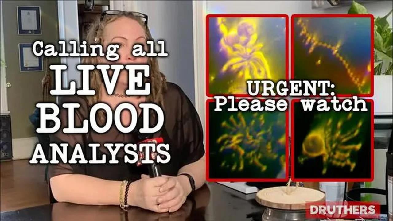 🔬 Qu'est-ce qu'il y a dans le sang des injectés ? avec Kelly Bacher ...