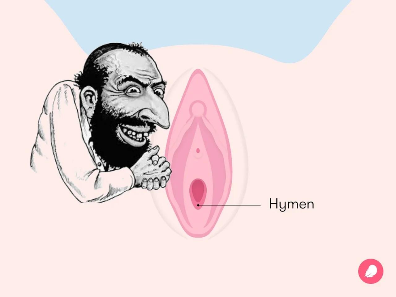 What the Talmud Teaches about the Hymen {Niddah 44b}