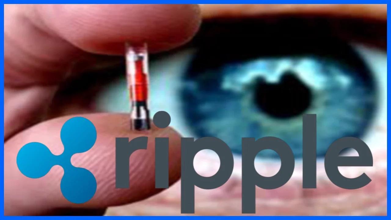 Ripple XRP & RFID Chip Implant