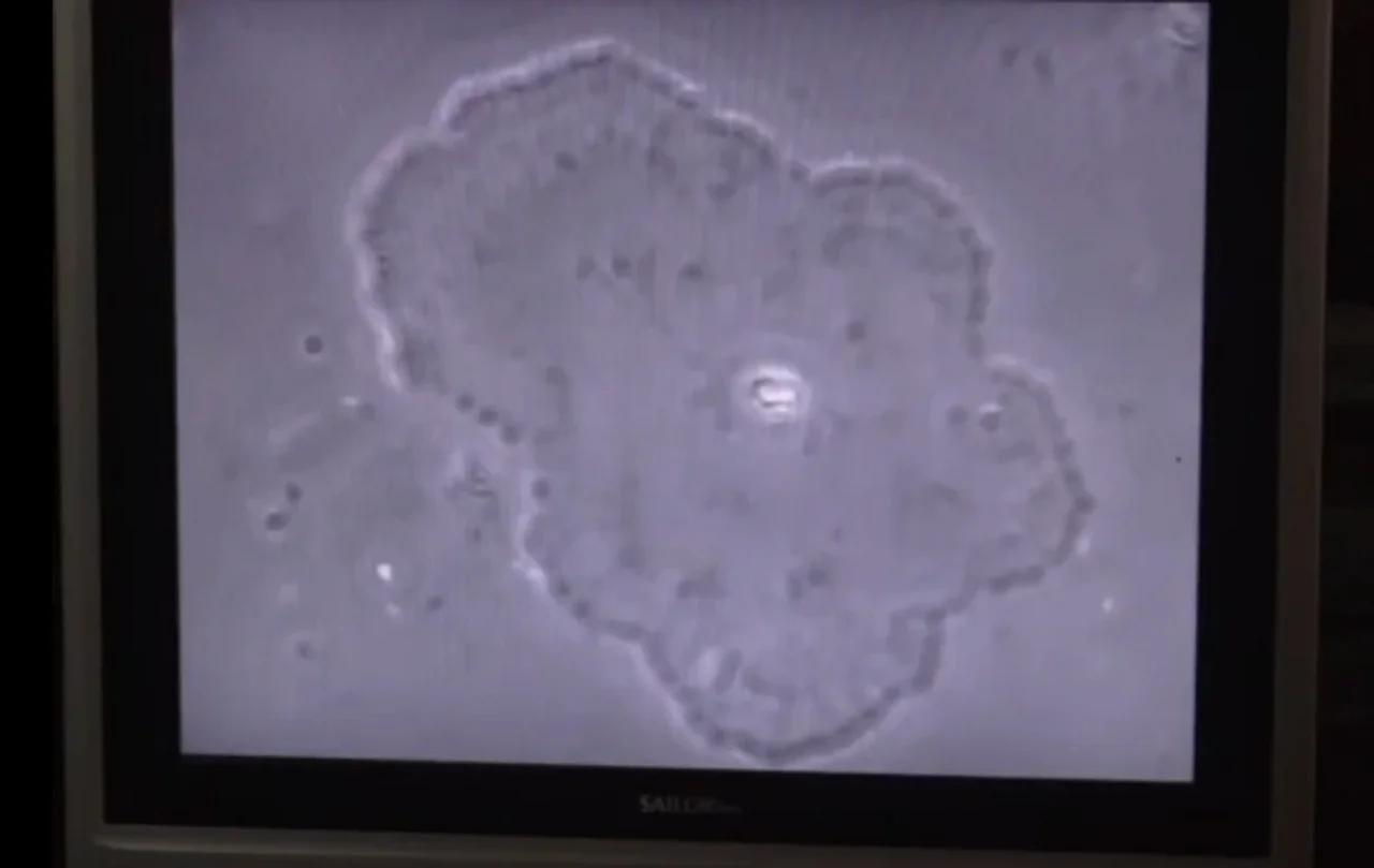 Salive d'un va-XX-iné - 13.03.2022 - un dentiste suisse explique qu'il ...