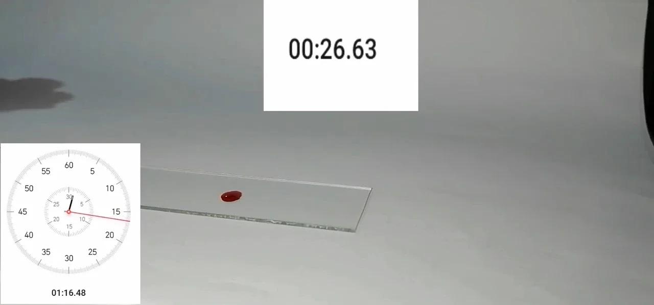 SLIDE METHOD CLOTTING TIME.