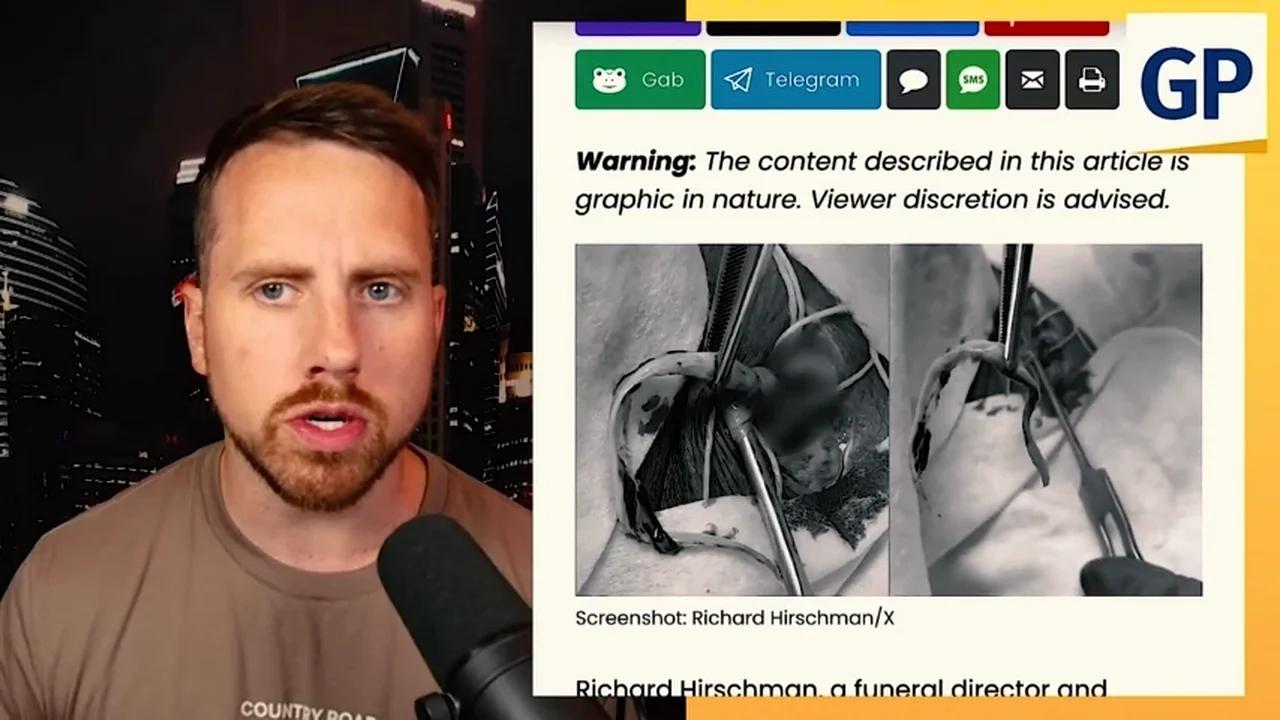 SHOCKING: Embalmer Finds "Strange White Fibrous Clots" in Dead Bodies ...