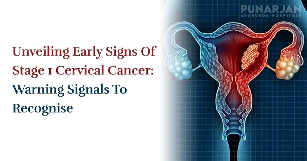 Unveiling Early Signs Of Stage 1 Cervical Cancer: Warning Signals To ...