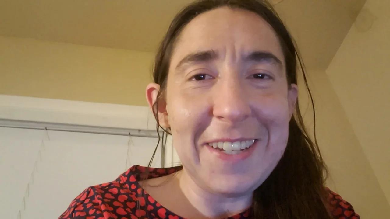 The Body Keeps the Scar: FFS & Clavicular Shortening on a Harmless ...