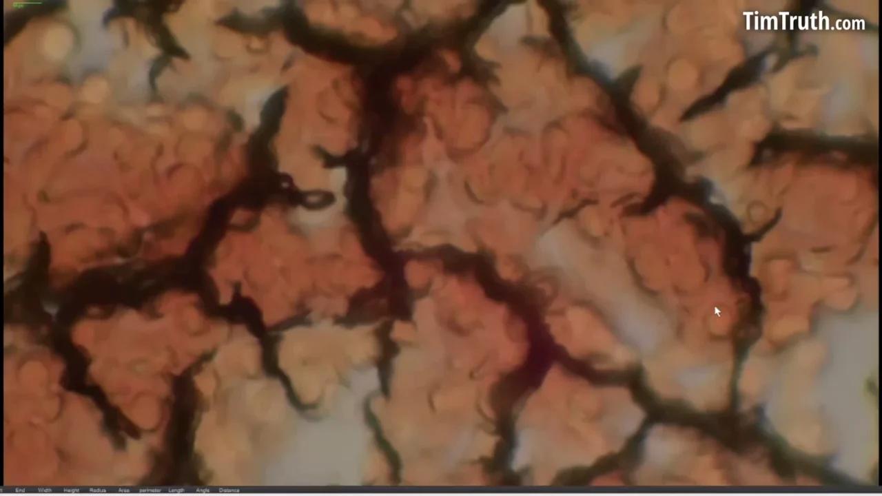 Dr Kevin McCairn et Dr Fleming : bactérie, sang corrompu et contaminants