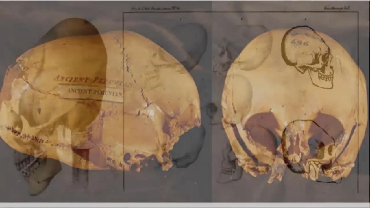 The Hidden Truth Of The Elongated Skull