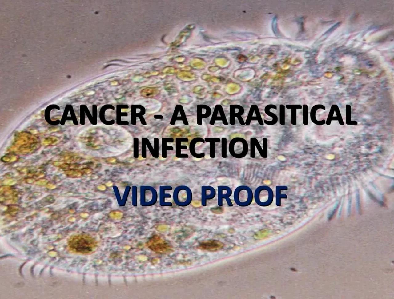 VIDEO PROOF: CANCER IS CAUSED BY PARASITES