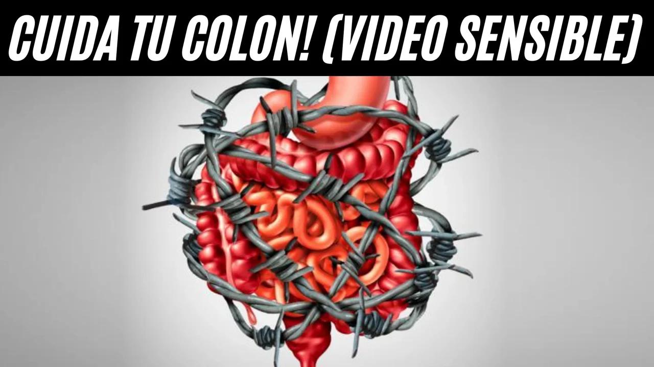 ¡Cuida tu colon! Protocolo “E” con CDS mejora tu salud 👌