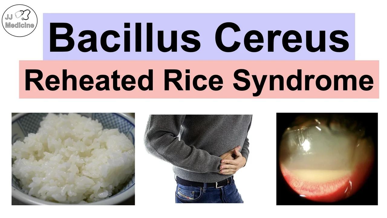 Bacillus Cereus (Reheated Rice Syndrome) | Food Poisoning ...
