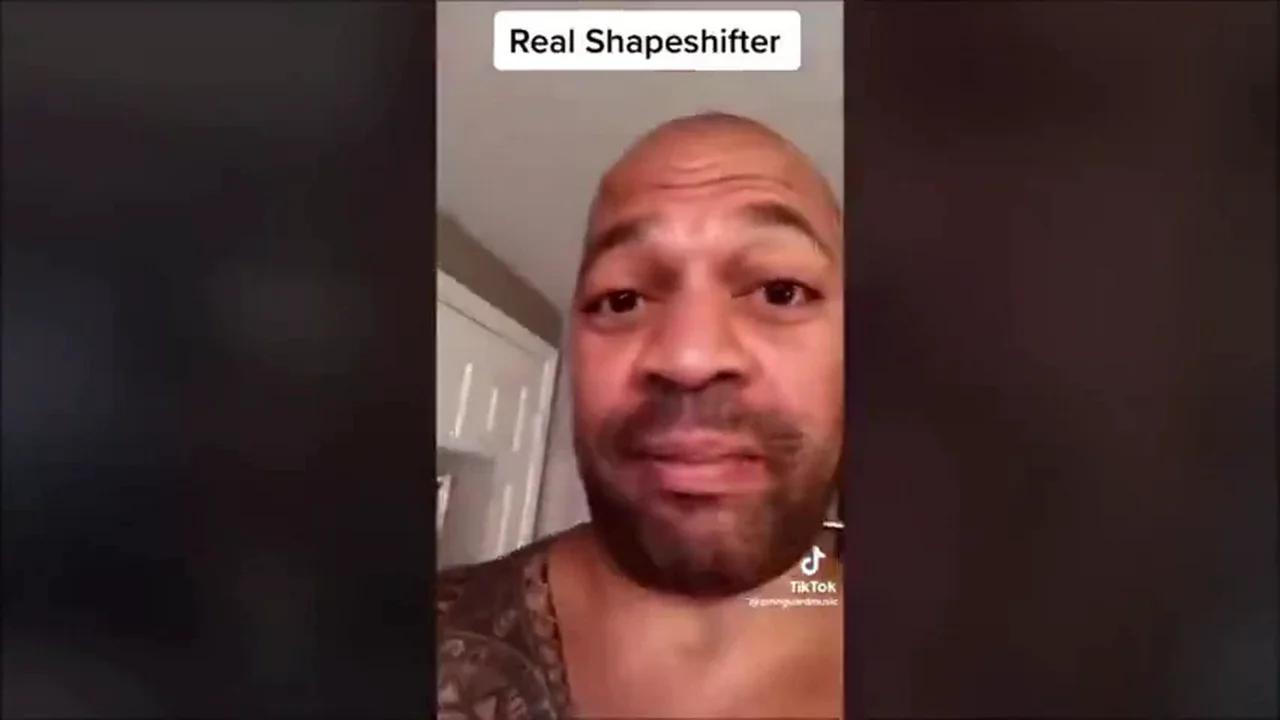 Vaccinated Man Says He Is Morphing Into Something Else