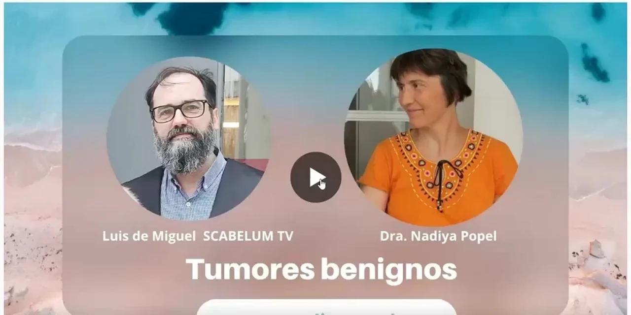 ¿QUÉ ES UN TUMOR BENIGNO