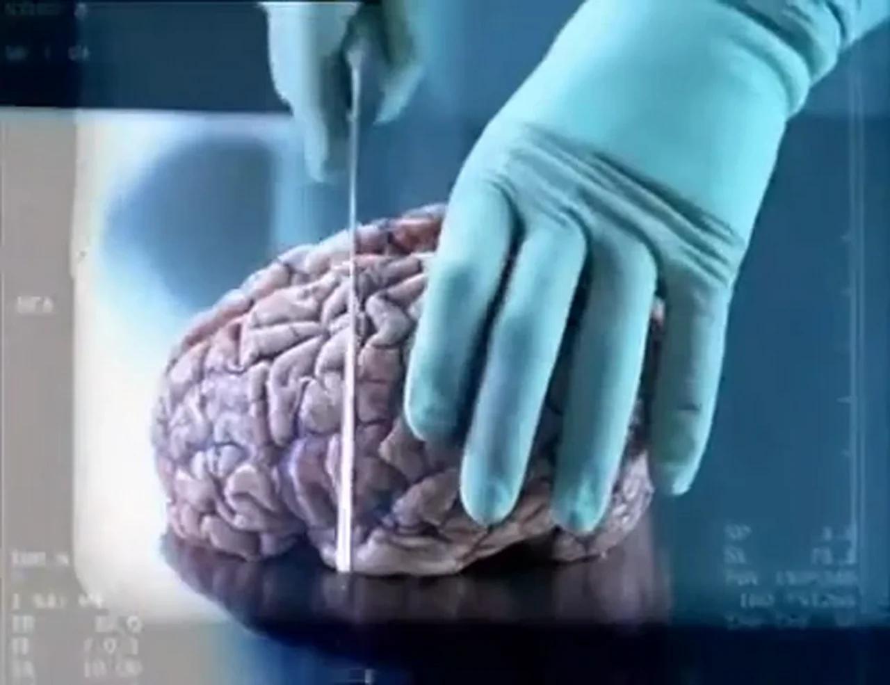 Quitline - Stroke (2000s, Australia)