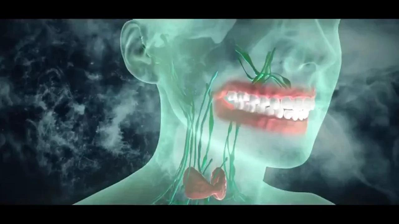 Root Cause - Root Canal Documentary